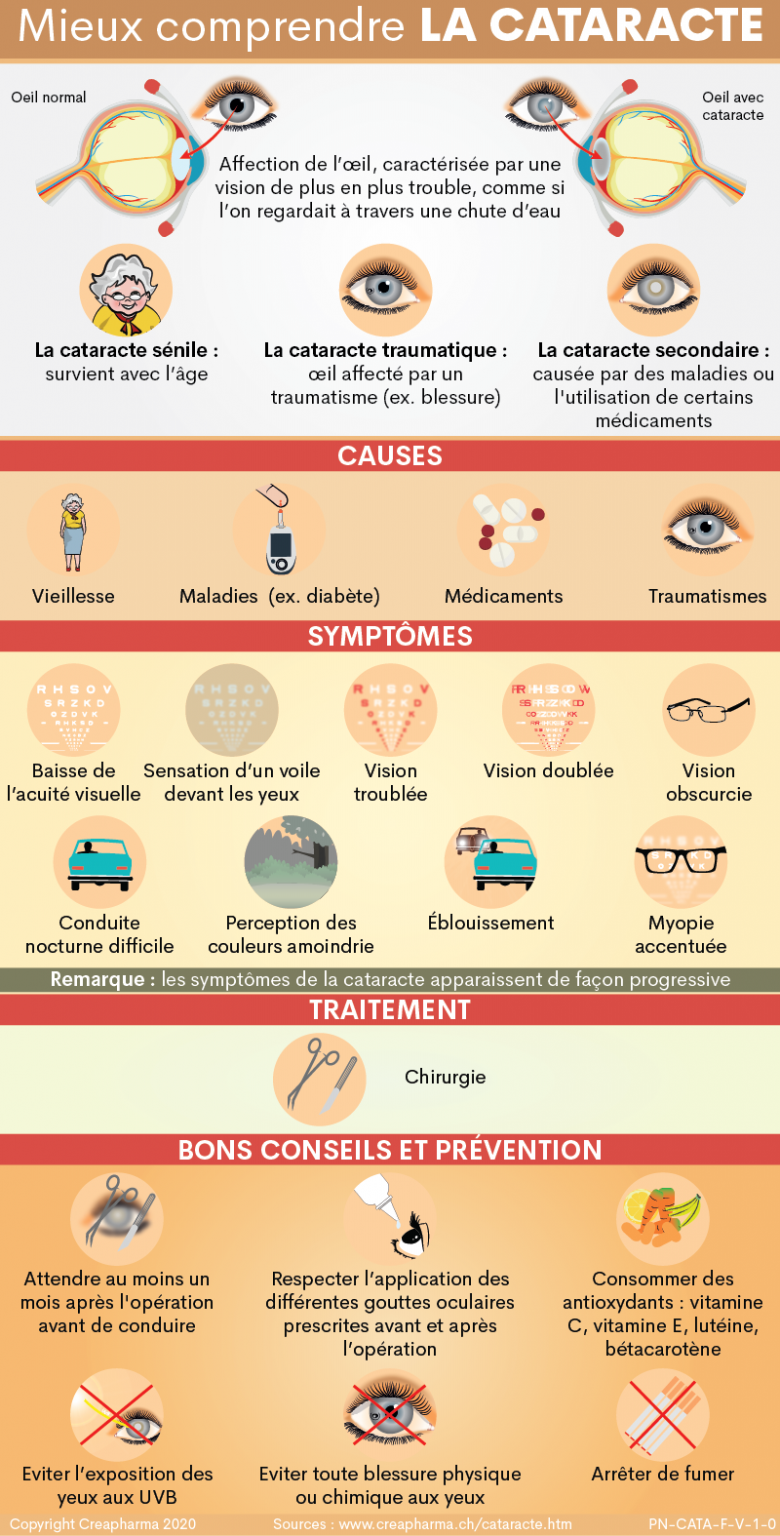 Cataracte : causes, symptômes & traitements | Creapharma